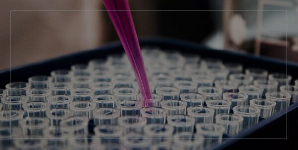 Our Products - Prevest DenPro Limited